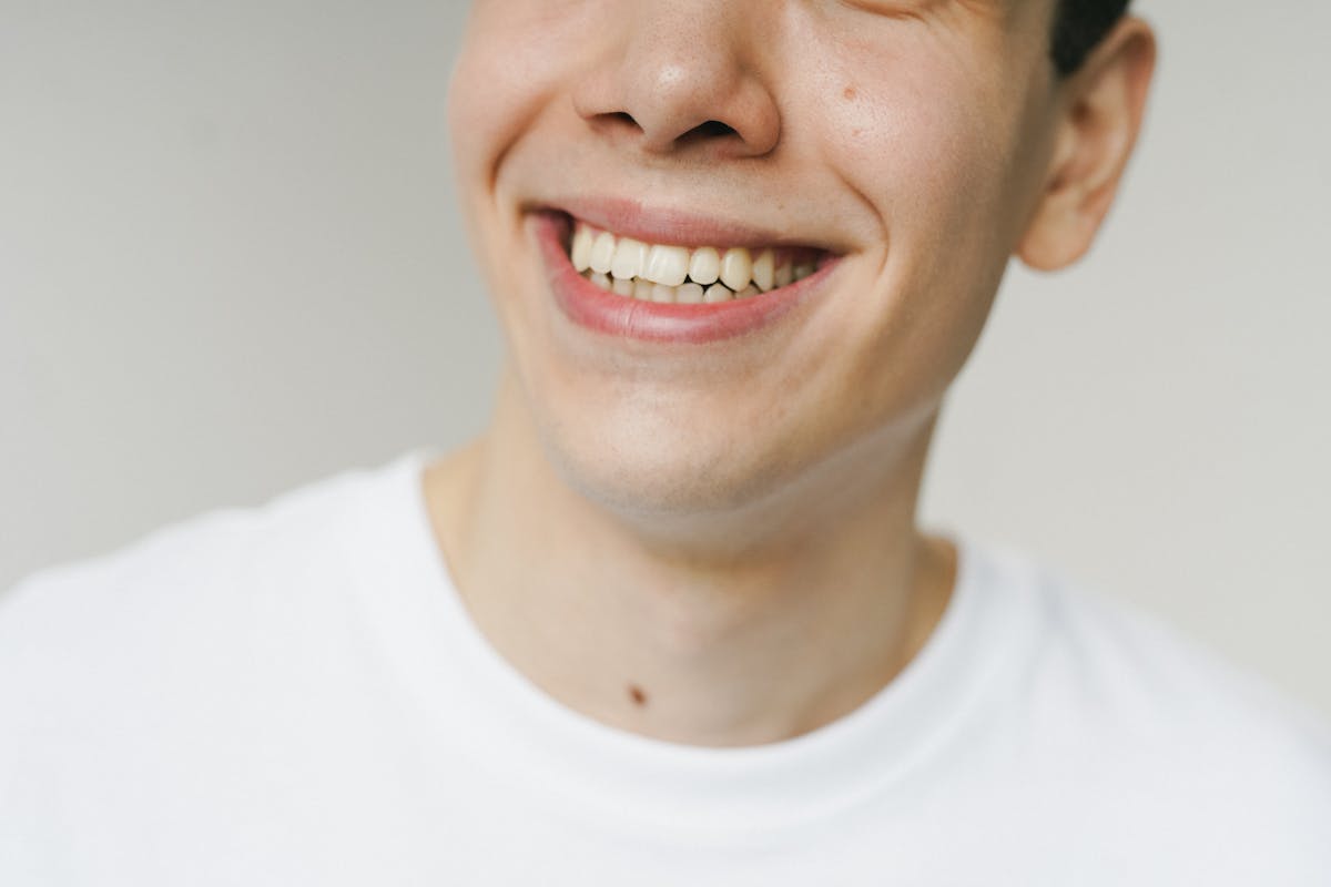 Do Nicotine Pouches Stain Your Teeth? Tips for Preventing ...
